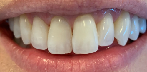 Before and After - Inna